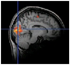New brain scan detects ‘instant’ biological changes – Mind Hacks
