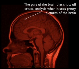 Area responsible for neuroscience errors located – Mind Hacks
